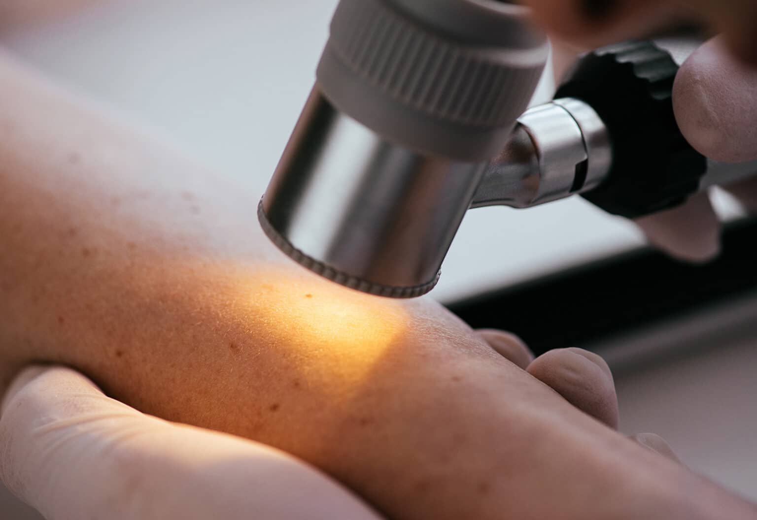 Skin & Mole Check | Skin Cancer Clinic Hornsby, NSW